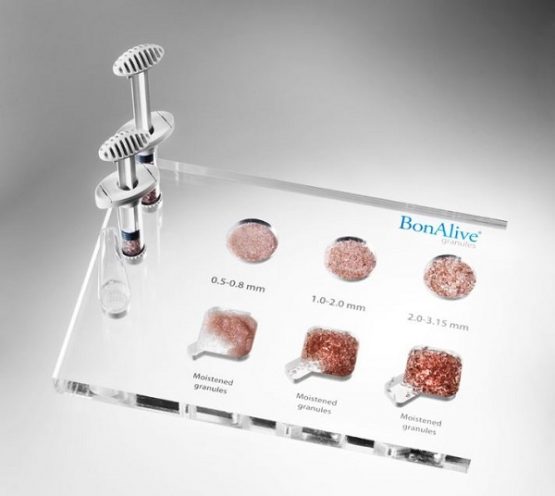 BonAlive_Granulat_1 | Hygiene und Medizintechnik Ralph Tiedemann